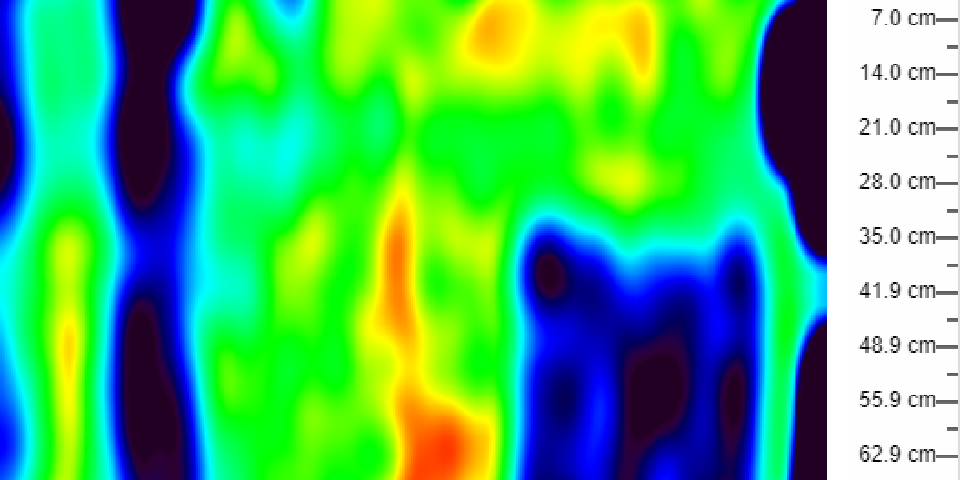 Elop Insight | Large Surface Concrete Scanner | 3-D Ultrasound Scanner